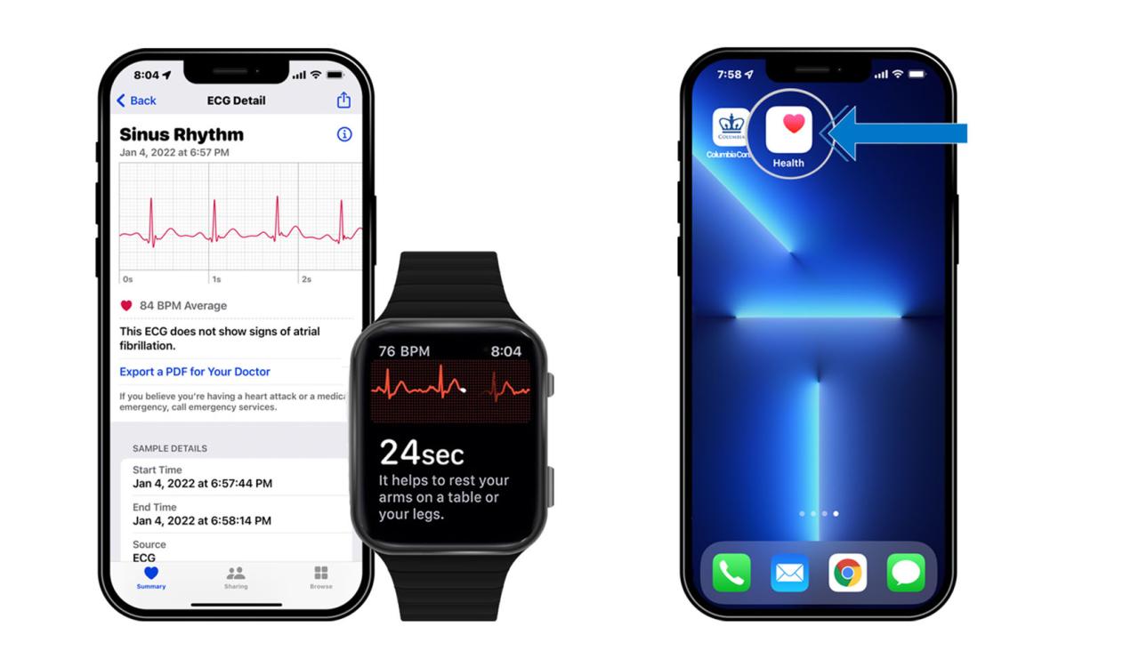 Share Your Apple Health ECG Results With Your Physician | ColumbiaDoctors