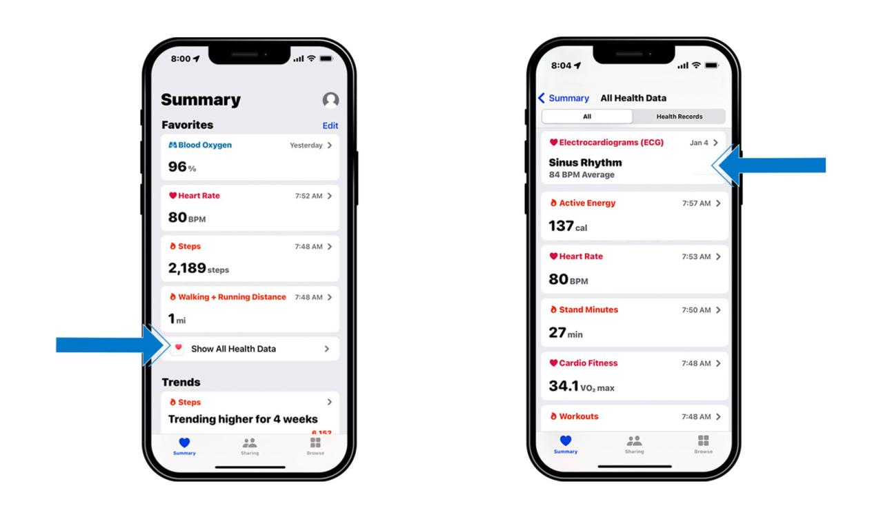 Share Your Apple Health ECG Results With Your Physician | ColumbiaDoctors