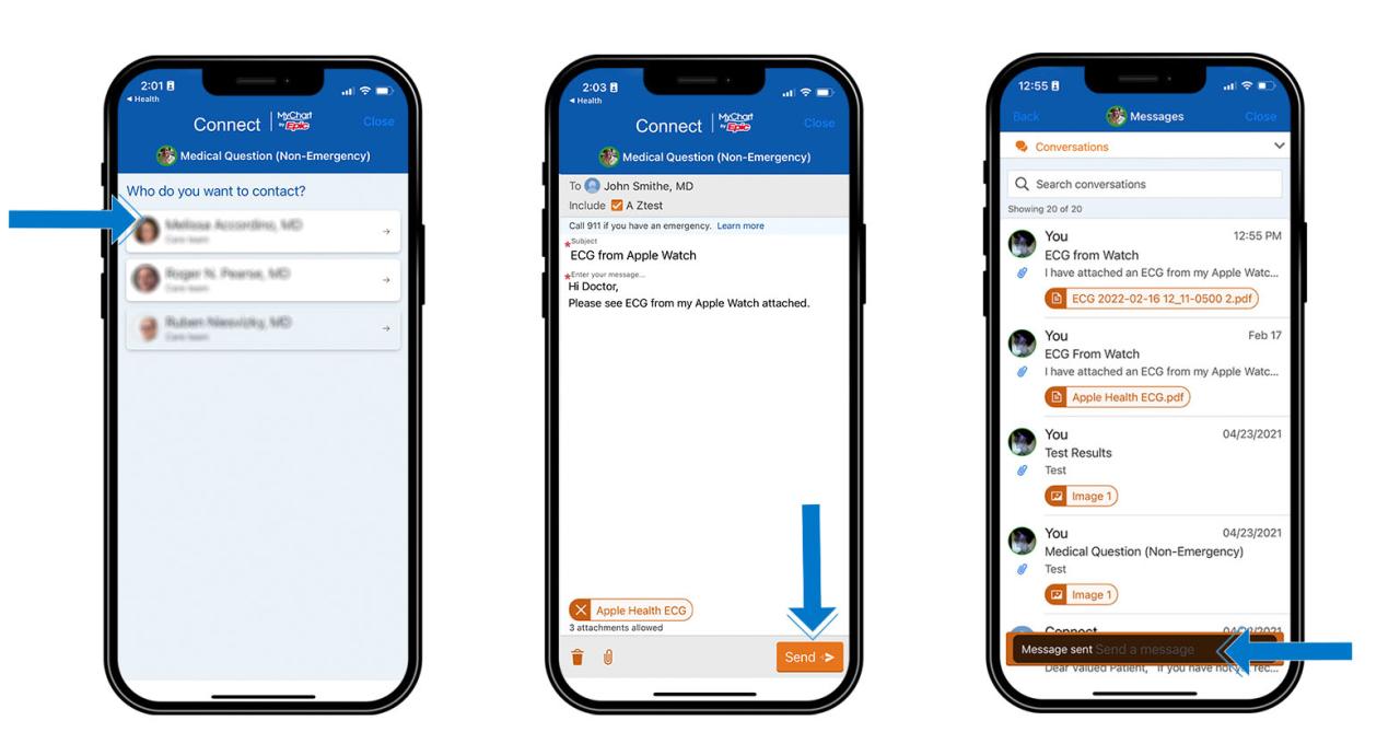 Share Your Apple Health ECG Results With Your Physician | ColumbiaDoctors