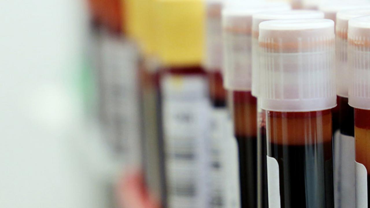 Pediatric Laboratory Services Midtown NYC | ColumbiaDoctors