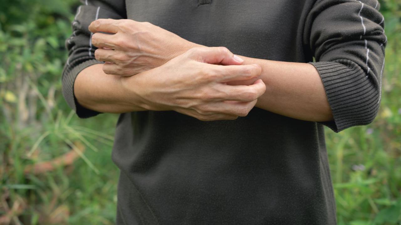 What is Neuropathic Itch? | ColumbiaDoctors