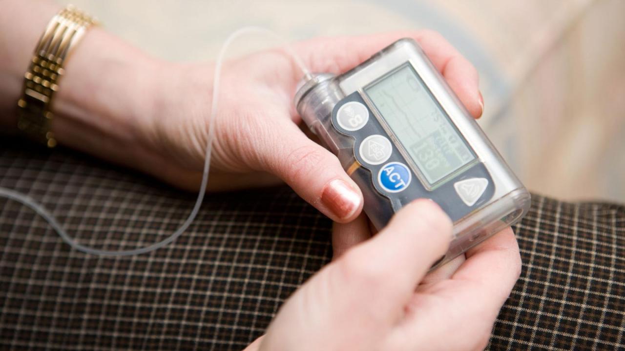 Insulin Pump Failure Management | ColumbiaDoctors