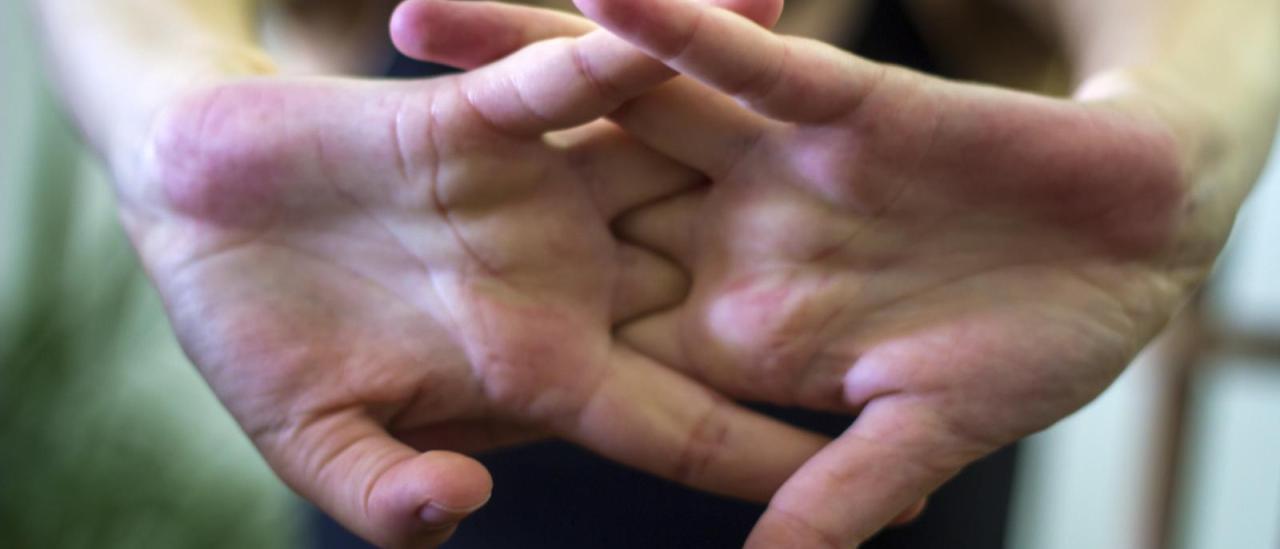 Is Cracking Knuckles Bad? A Columbia Rheumatologist Explains ...