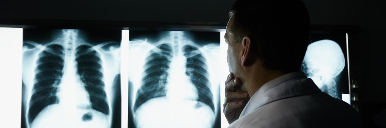 Thoracic Surgery - NYC | ColumbiaDoctors - New York