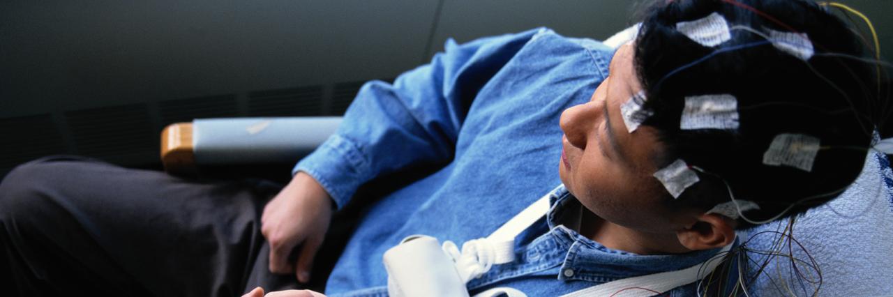 Epilepsy Treatment - NYC & Westchester | Columbia Neurology ...