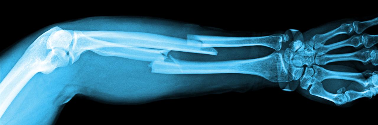 X-ray Services - NYC & Westchester | ColumbiaDoctors - New York ...