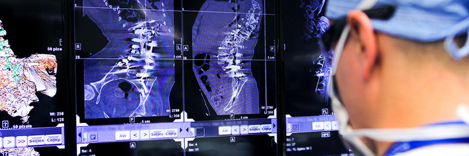 Columbia at Och Spine at NewYork-Presbyterian - NYC and Westchester | ColumbiaDoctors ...