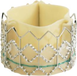 What is TAVR? Experts Explain the Groundbreaking Procedure that ...