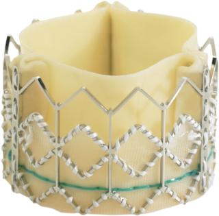 What is TAVR? Experts Explain the Groundbreaking Procedure that ...