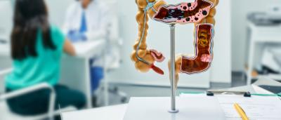 How to Know Your Colon is Healthy | ColumbiaDoctors - New York