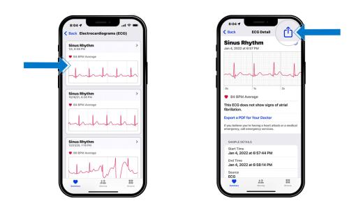 Share Your Apple Health ECG Results With Your Physician | ColumbiaDoctors