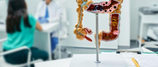 How to Know Your Colon is Healthy | ColumbiaDoctors - New York