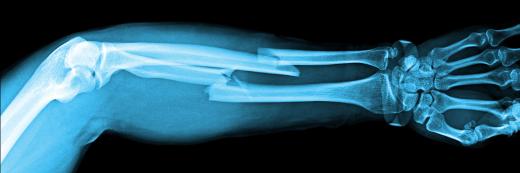 X-ray Services - NYC & Westchester | ColumbiaDoctors - New York ...