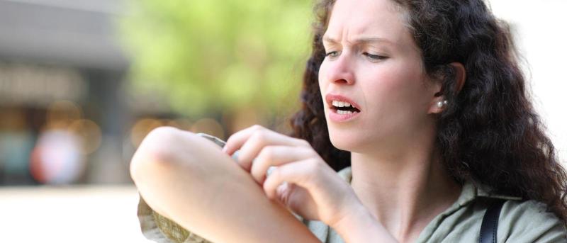 How to Stop Bug Bites from Itching | ColumbiaDoctors
