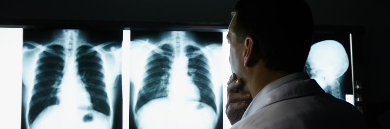 Thoracic Surgery - NYC | ColumbiaDoctors